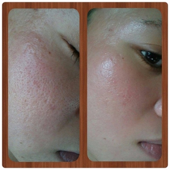 Magic Skin Repair | Other | Magic Skin Repair Oil | Poshmark